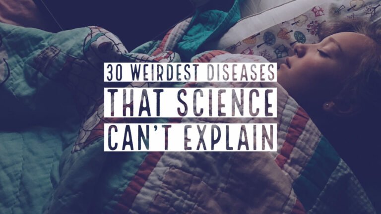 30 Weirdest Diseases That Science Can't Explain - Origin Of Idea